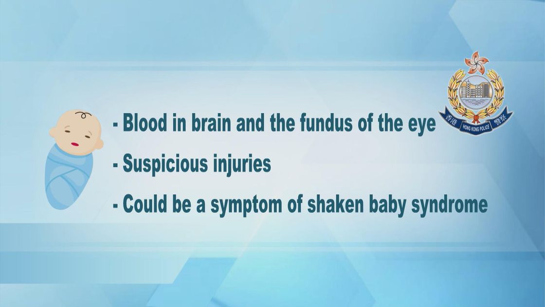Police arrest helpers after four-month-old baby suffers brain bleed | 無綫新聞TVB News